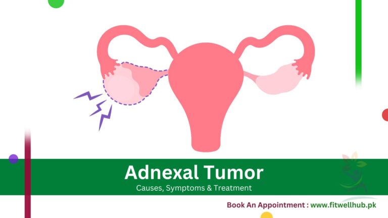 Adnexal Tumors | Causes, Symptoms, & Treatment Guide
